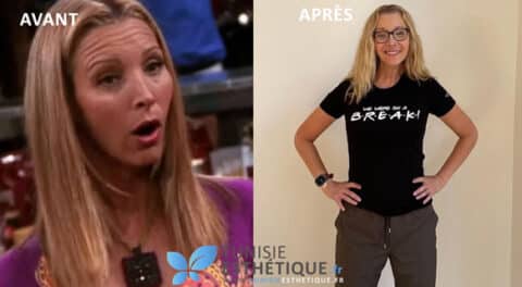 Les acteurs de Friends avant et après la chirurgie esthétique